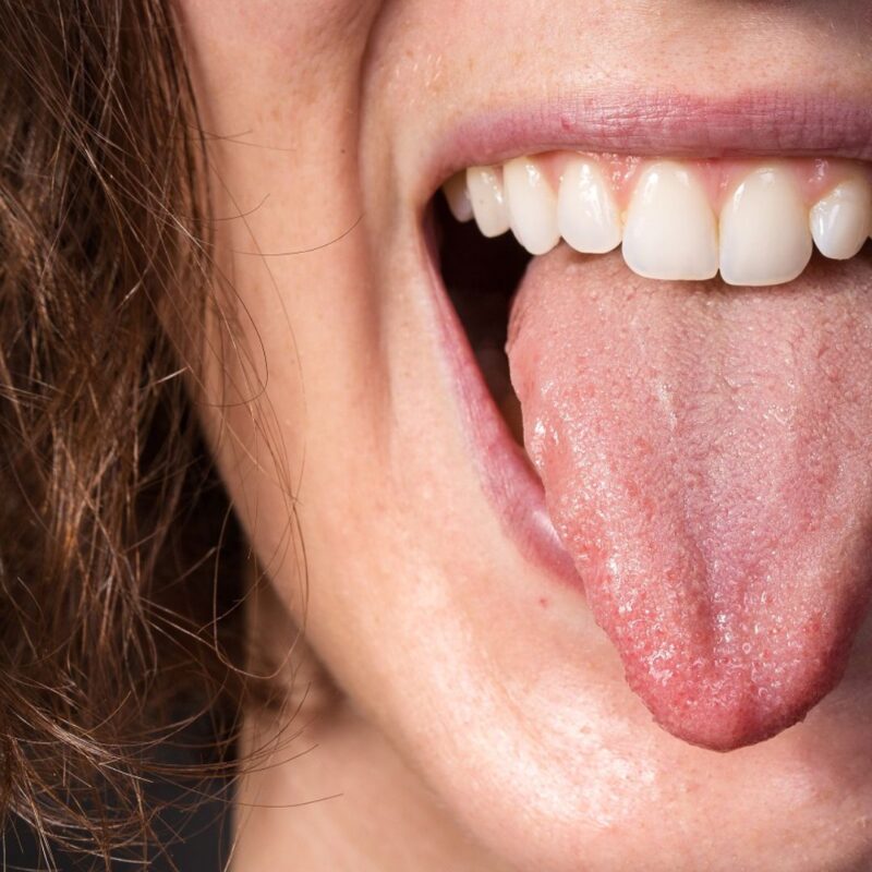 Qu'est-ce que les candidoses ? Origine et traitement - Familles Santé ...